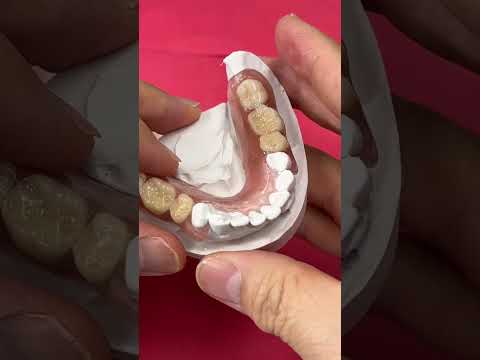 What Des Mand Partial Flex Base Means In Dentistry