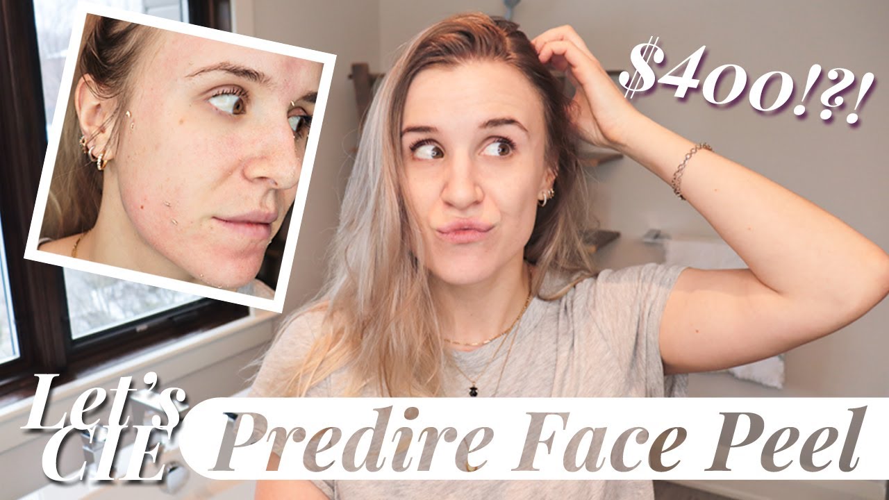 400$ & my SKIN PEELS OFF?! Predire FACE PEEL| Let's Cie |CIEKAIKAI ...
