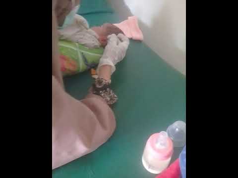 Baby Qila memakai anting