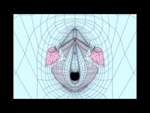 Vaginal Labiaplasty Explained - Wedge Method