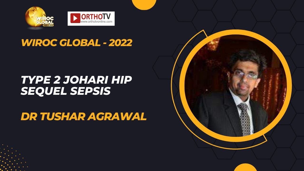 Wiroc Global 2022 : Type 2 Johari hip sequel sepsis - DR TUSHAR AGRAWAL - YouTube
