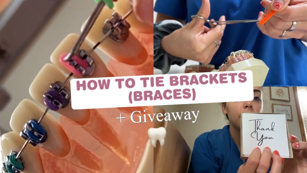 GIVEAWAY + A Day In The Life Of An Orthodontic Assistant + How To Tie ...