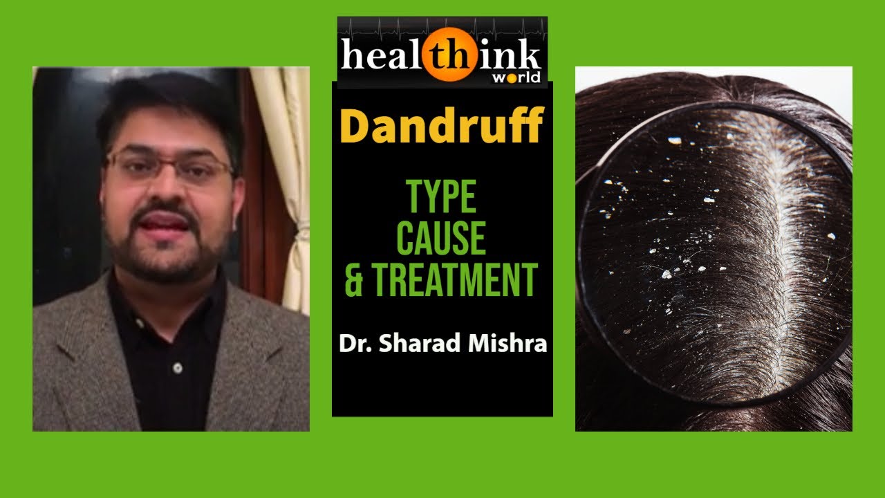 Dandruff - different types need different treatment - YouTube
