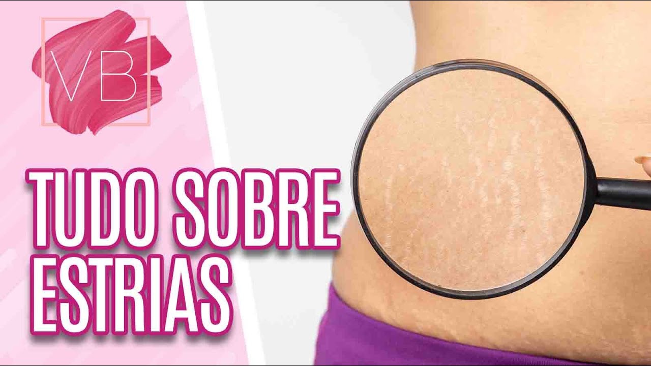 Conheça os tipos de estrias e como tratá-las | Momento Beleza - Você ...