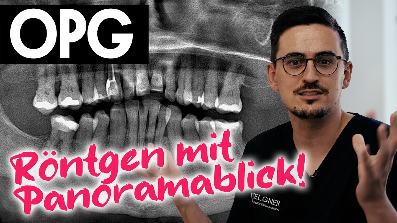 Panoramaschichtaufnahme / OPG - Röntgenbild mit Panoramafunktion - YouTube