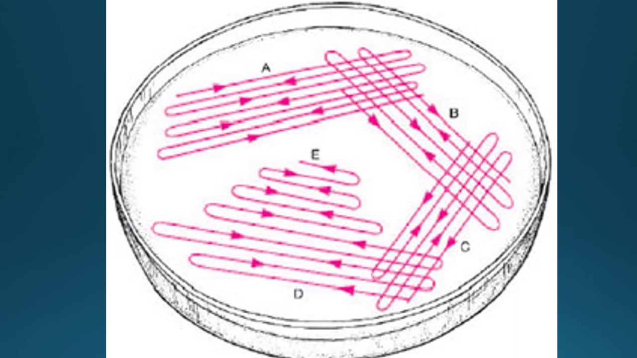 Bacteremia types and its lab diagnosis - YouTube
