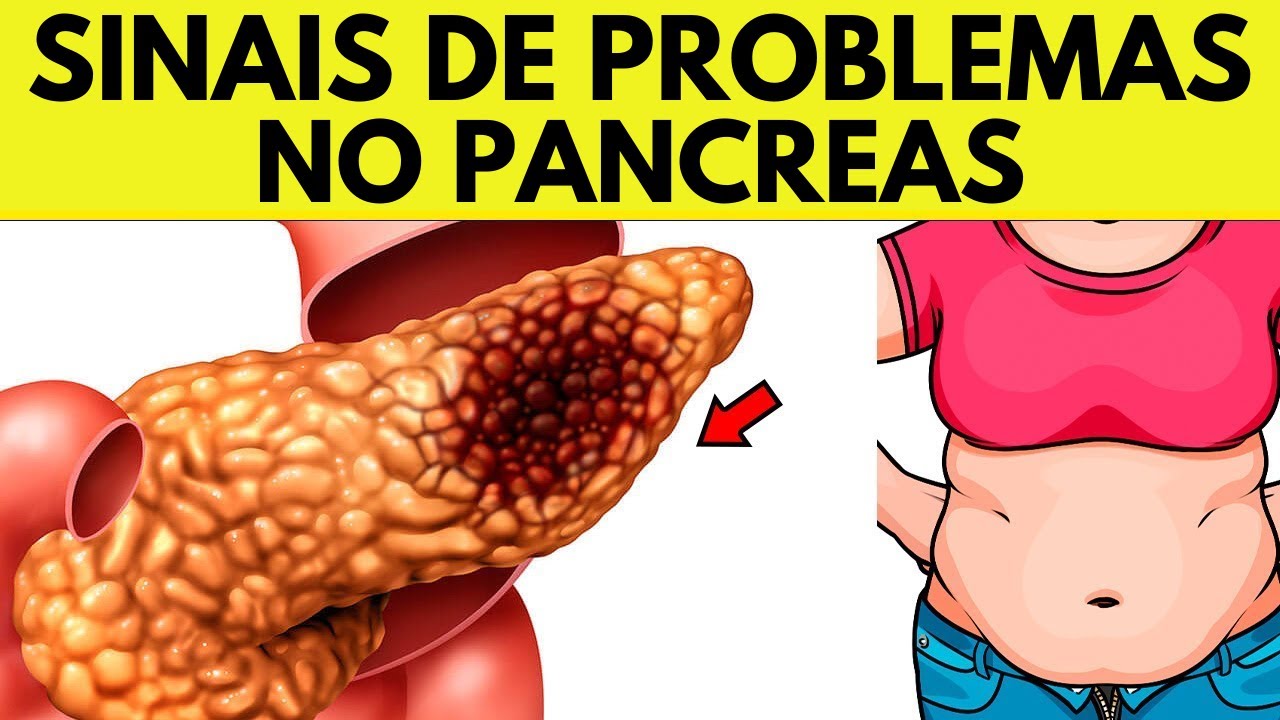 7 sintomas SILENCIOSOS DE PROBLEMAS NO PÂNCREAS, RISCO E QUANDO IR AO ...