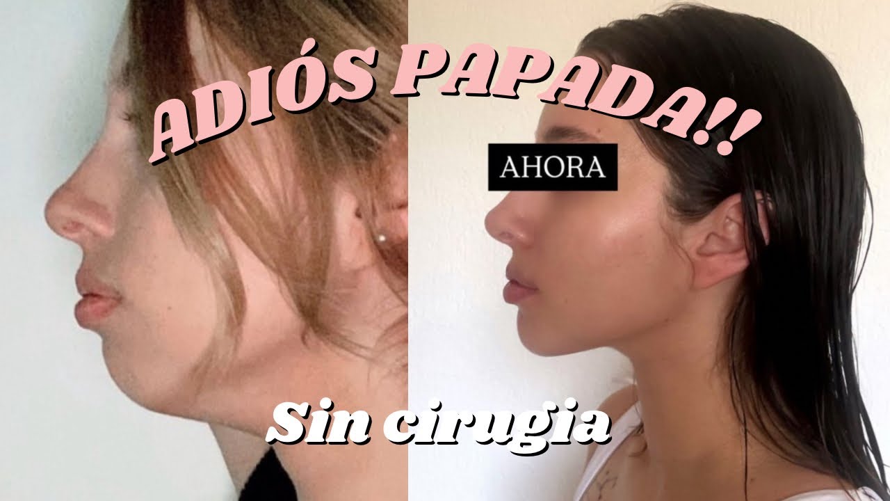ADIOS PAPADA! DEFINE TU MANDIBULA SIN CIRUGIA Y DESDE CASA - YouTube