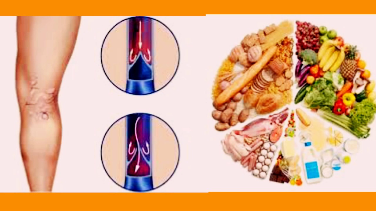 Problemas Circulatorios, cómo Prevenirlos. - YouTube