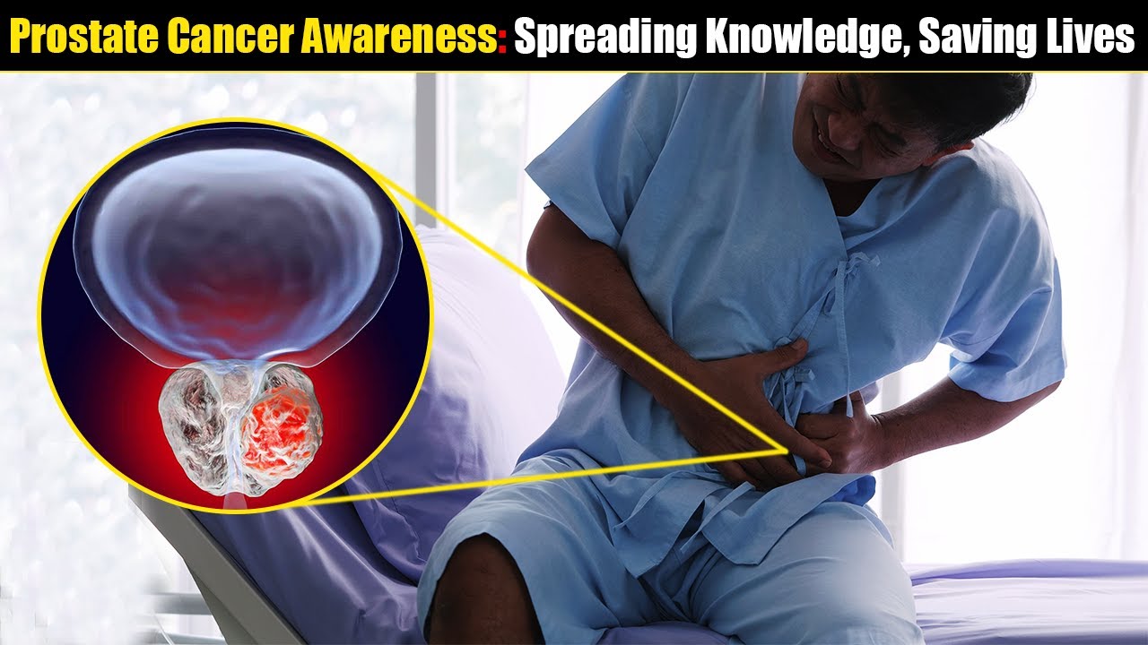 Prostate Cancer Youtube 7978
