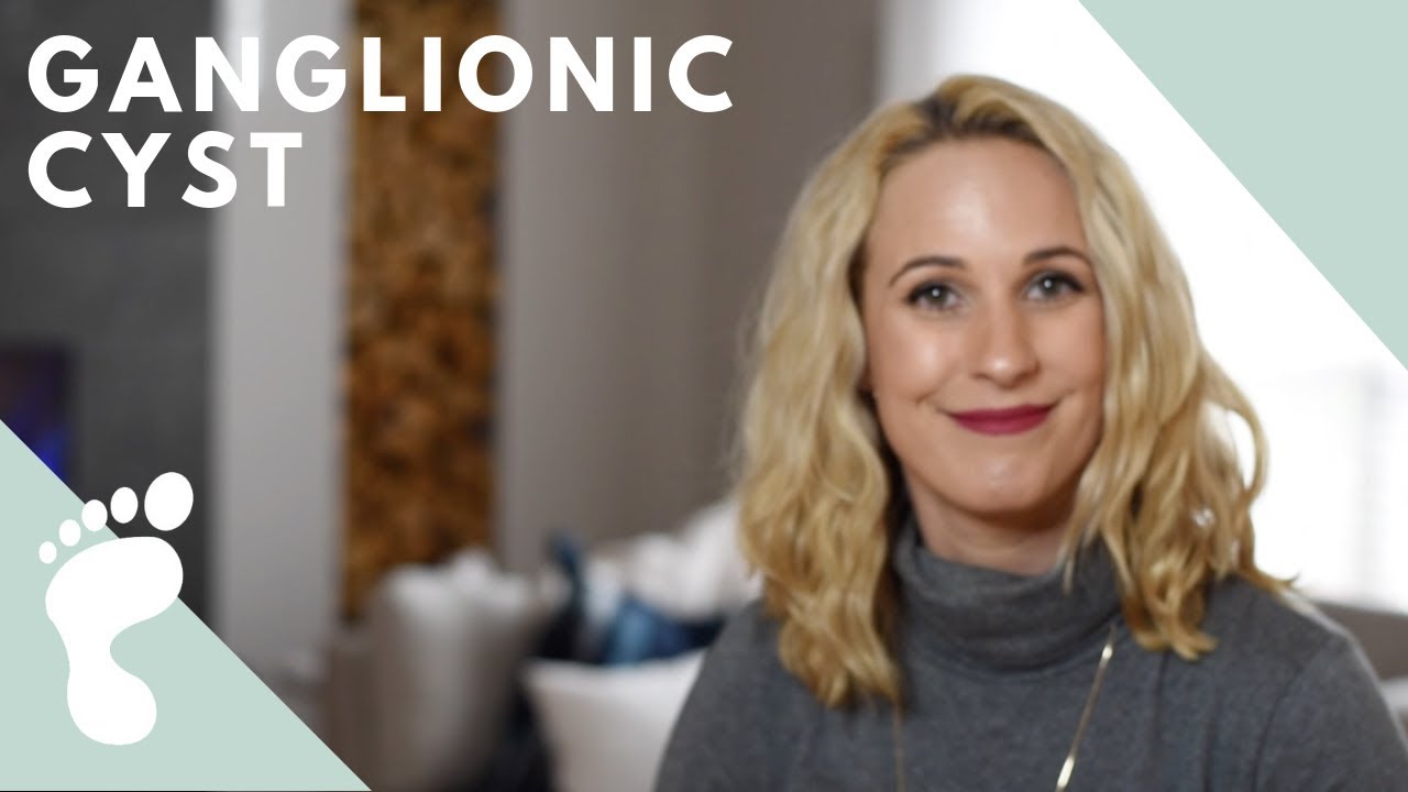 Dr. Freels Explains Ganglionic Cysts and Potential Treatment Options ...