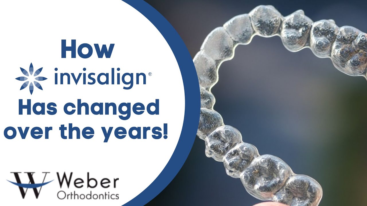 How Invisalign Has Changed Over the Years! | Braces and Invisalign ...