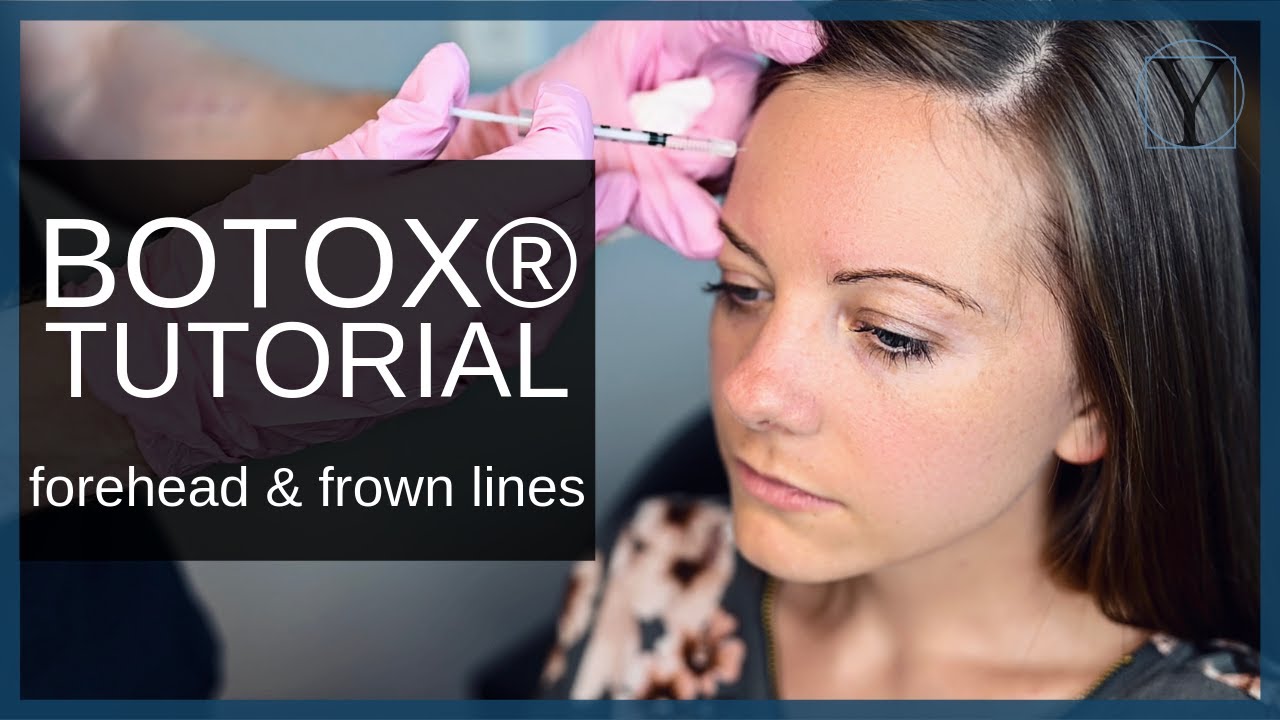 BOTOX® Injection | Forehead Wrinkles and Frown Lines | Atlanta Botox ...