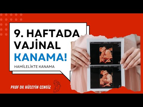🤰 9. Haftada Vajinal Kanama! 😨 Ne Anlama Geliyor? İşte Tüm Sebepler ve Çözümler!
