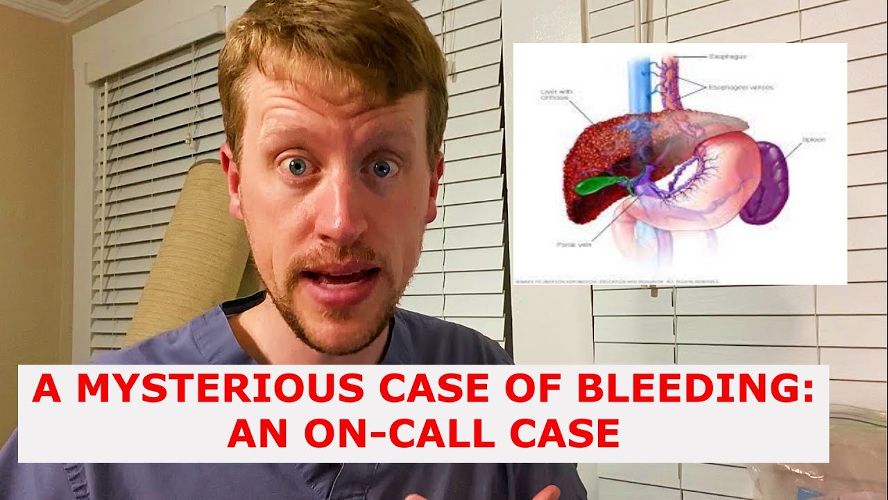 A Mysterious Case of Bleeding: An On-Call GI Case - YouTube