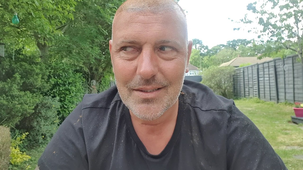 Get your hair back with Marmite - YouTube