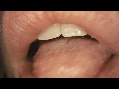 Get Swallowed! MOUTH TOUR HD - CLOSE UP (5 MIN) ASMR VORE FEMALE~ go Deep down her throat!
