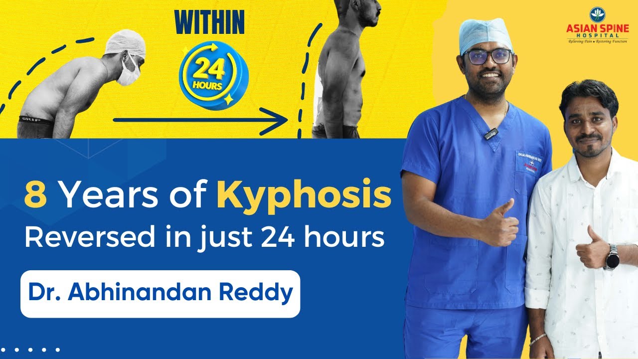 Life-Changing Spine Surgery : 8 Years of Kyphosis Reversed in just 24 ...