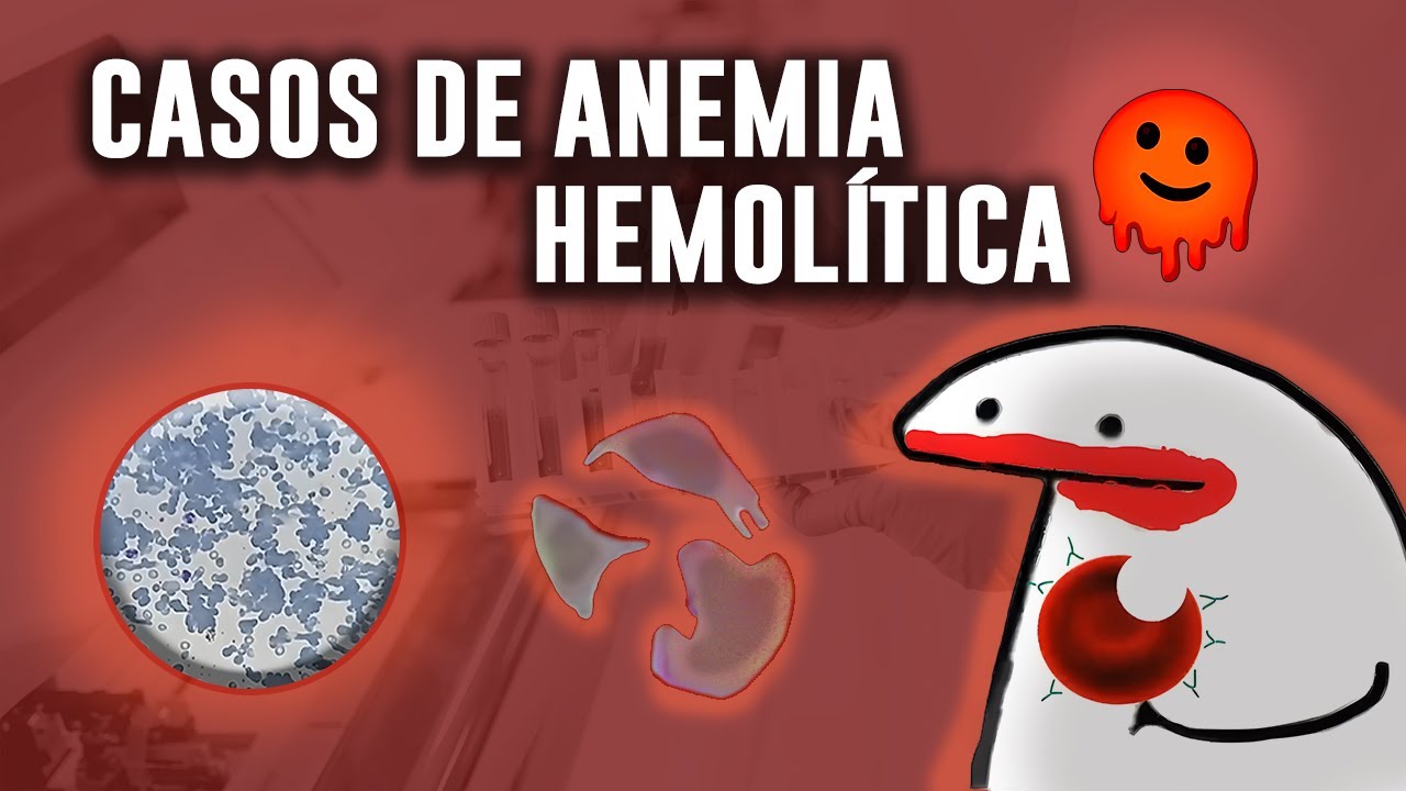 DESAFÍA tu CONOCIMIENTO con estos CASOS CLÍNICOS de ANEMIA HEMOLÍTICA ...