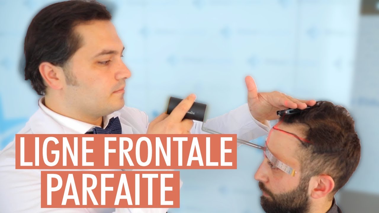Le Dr Balwi vous informe : la ligne frontale parfaite - YouTube
