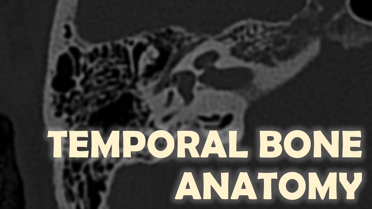 Anatomy of the Temporal Bone on Imaging - YouTube