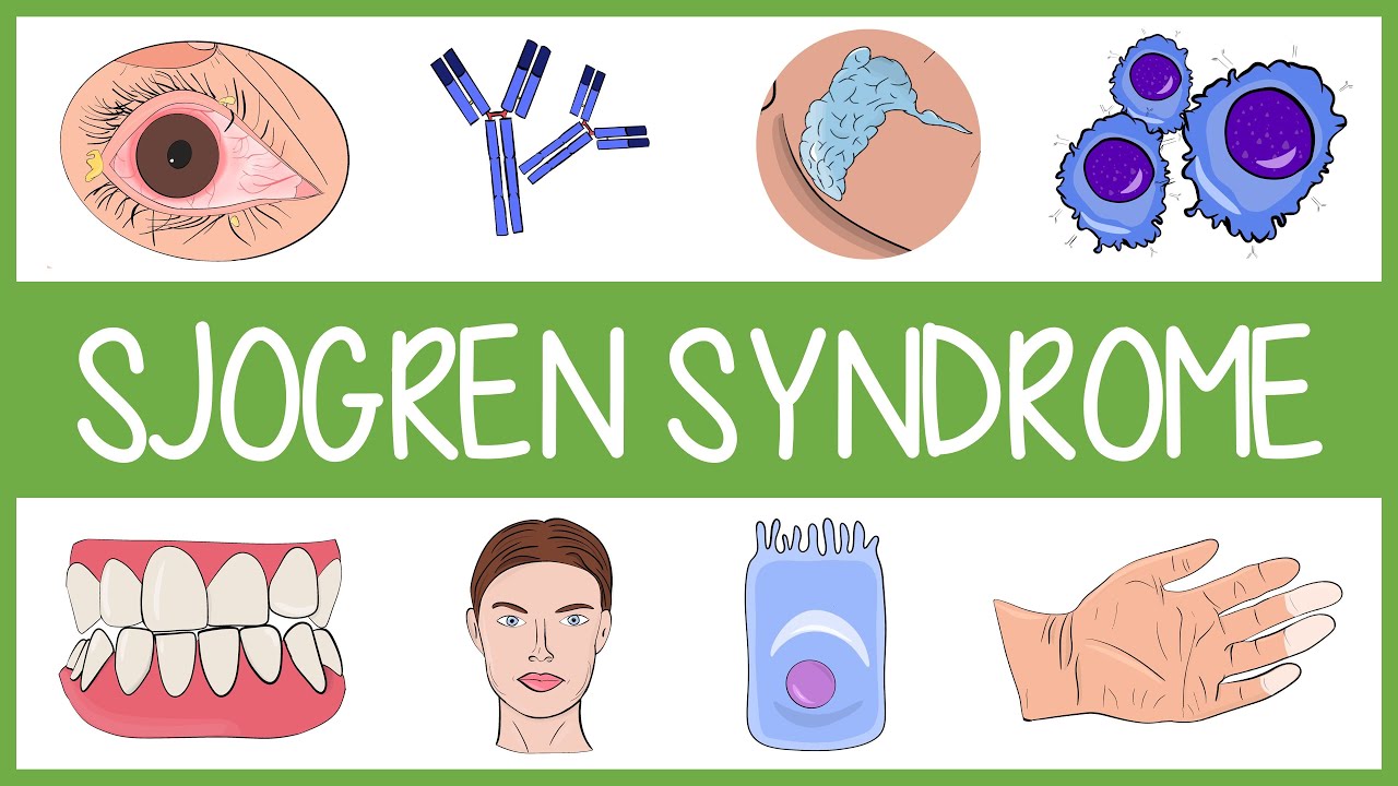Sjogren Syndrome Visually Explained - YouTube