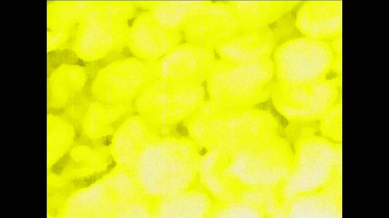 THE MIDAS SONG - YouTube