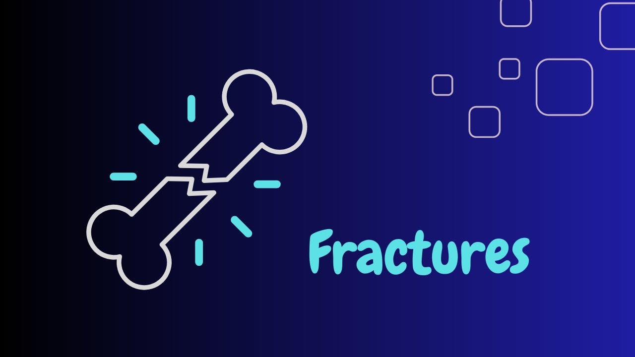 Orthopedics / fractures lecture 1 - YouTube