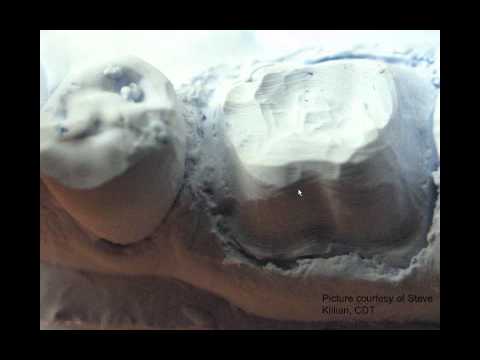 What Does Pvs Stand For In Dentistry