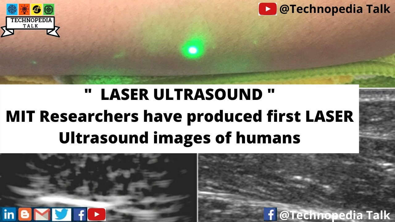 LASER Ultrasound ║ MIT Researchers have produced first laser ultrasound ...