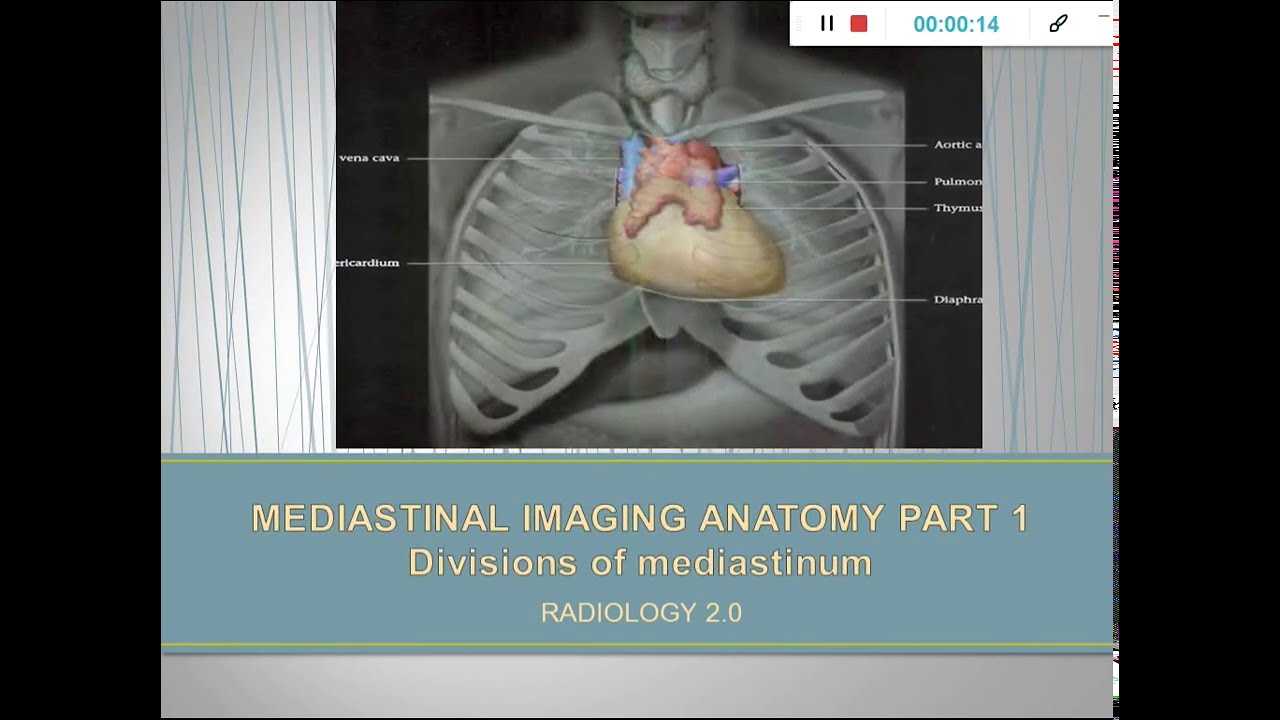 Mediastinal classification and anatomy/Radiology Teaching - YouTube