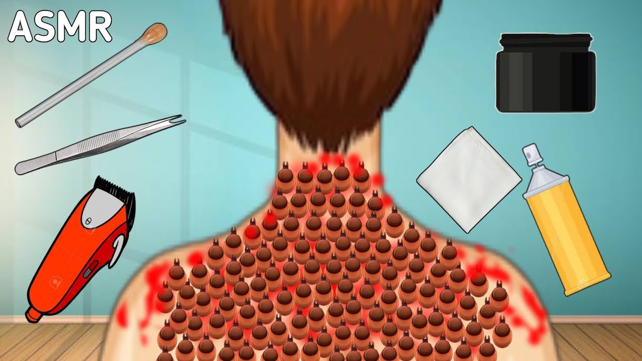 ASMR removal of lice tick from back neck//ASMR treatment//Beauty ASMR ...