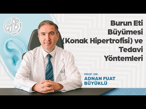 Burun Eti Büyümesi (Konak Hipertrofisi) ve Tedavi Yöntemleri | Prof. Dr. Adnan Fuat Büyüklü