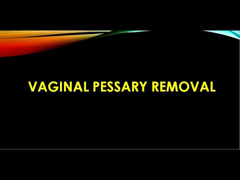 Vaginal Pessary Removal. (95) - YouTube