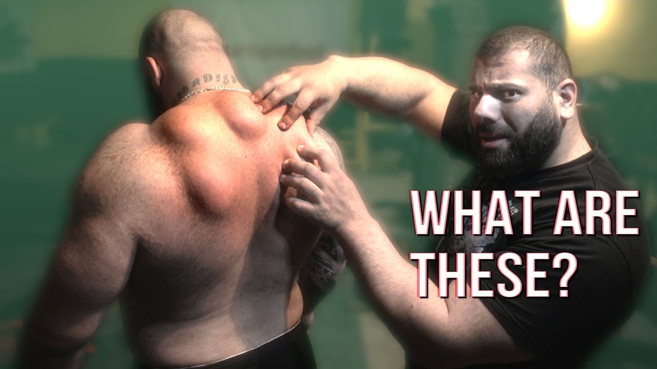 What's underneath Konstantine's enormous traps, Synthol? Implants ...