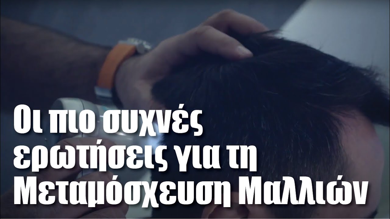 HairTransplant Μεταμόσχευση Μαλλιών - YouTube