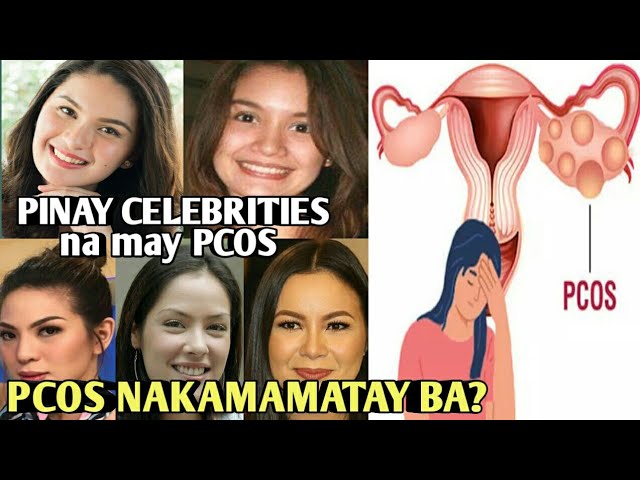 Celebrities With Pcos 60 Photos - Moonagedaydream.film