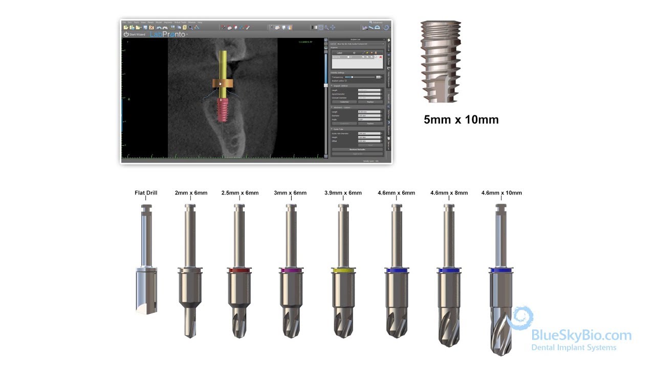Bio | Max Fully Guided Keyless Surgical Kit - YouTube