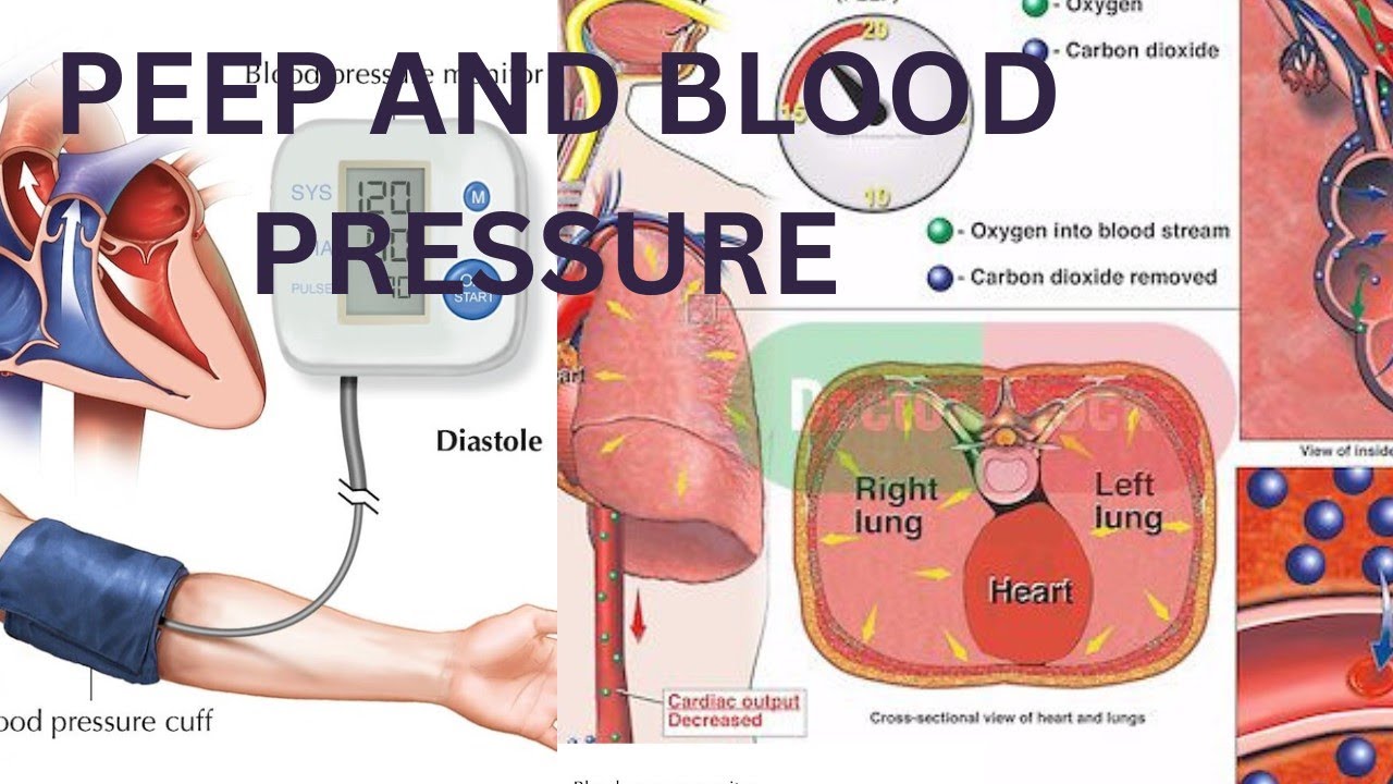 positive end expiratory pressure | how PEEP decreases blood pressure ...