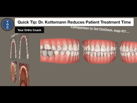 Dr. Bill Kottemann reduces patient treatment times using Invisalign and ...