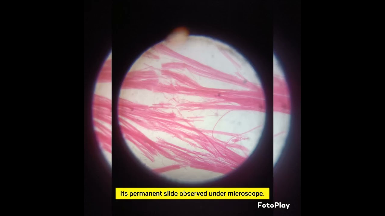 permanent slide of striated muscle tissue : microscopic view.🔬 - YouTube