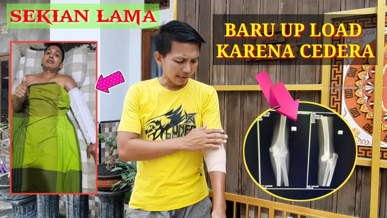 SEKIAN LAMA GA UP LOAD VIDEO KARENA CEDERA // ADA HOBY BARU - YouTube