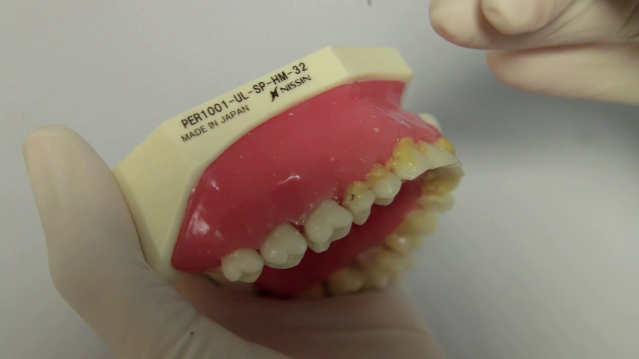 [Periodontal Examination Series] 12. Furcation Involvement (Glickman ...