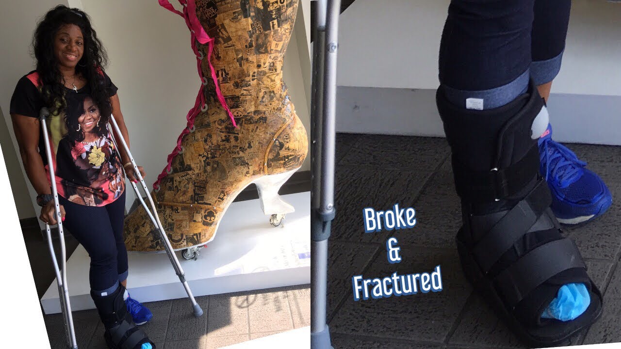 Fell Down The Steps! (Broke & Fractured My Foot..) - YouTube