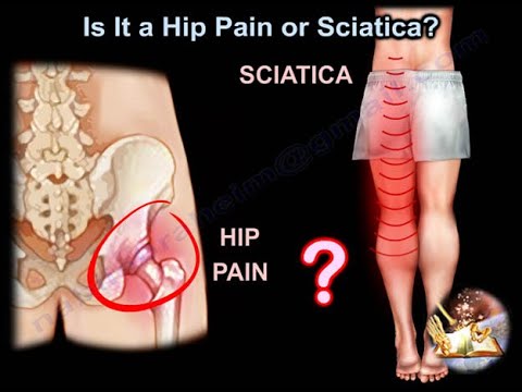 How To Tell The Difference Between Sciatica Pain And Bursitis