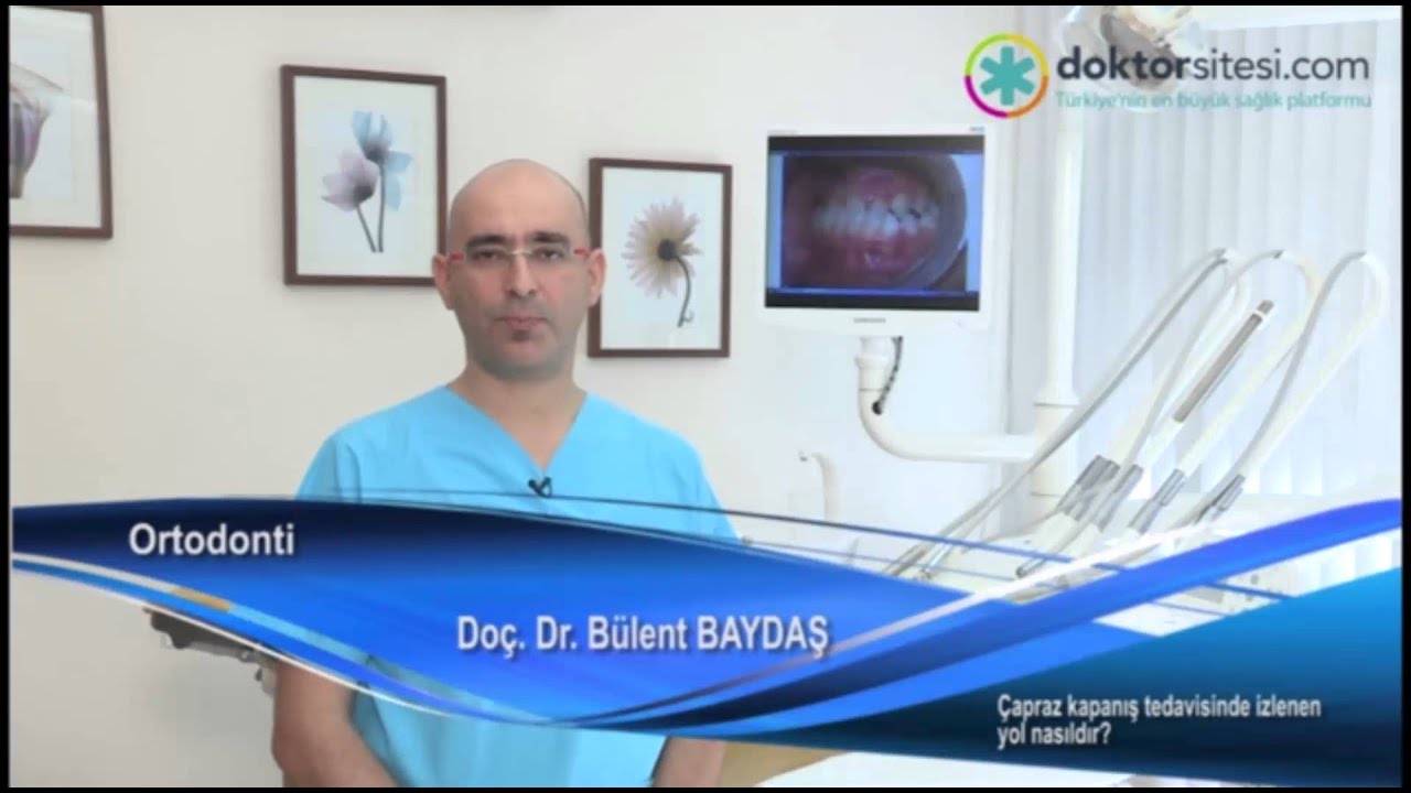 Çapraz kapanış tedavisinde izlenen yol nasıldır? - YouTube
