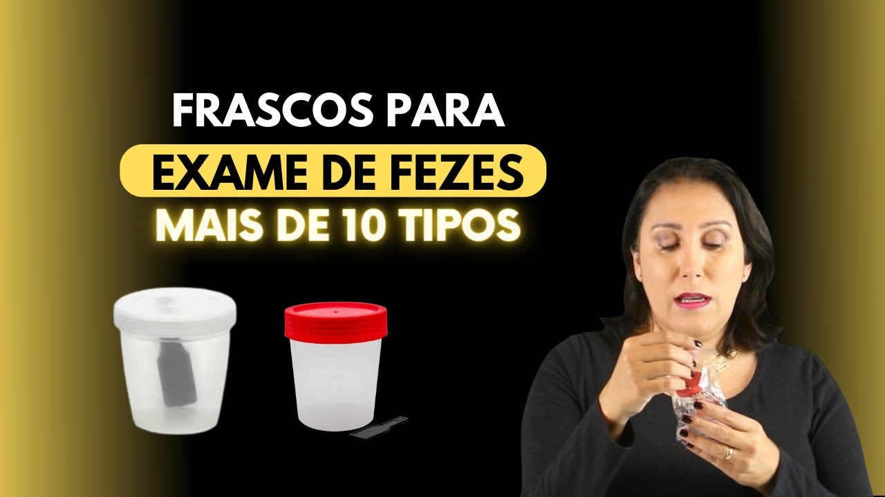 Veja mais de 10 exemplos de frascos para Exame Parasitológico de Fezes ...