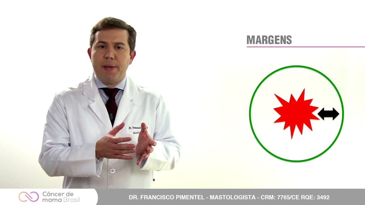 CIRURGIA CONSERVADORA (QUADRANTECTOMIA) OU MASTECTOMIA? - YouTube