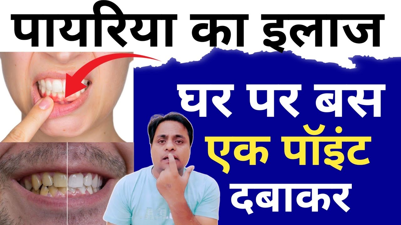 पायरिया का इलाज। Sujok Therapy For Payriya। Acupressure Points For ...