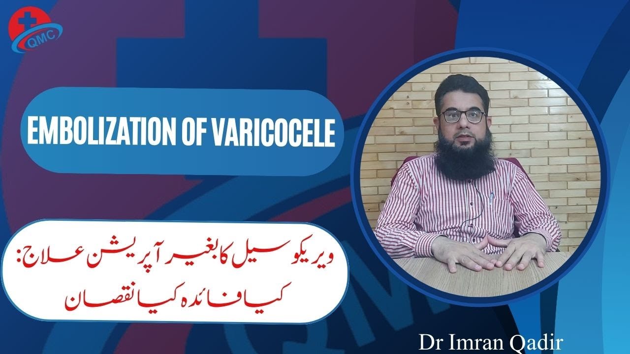 Embolization of varicocele: Pro & consویریکوسیل کا بغیر آپریشن علاج ...